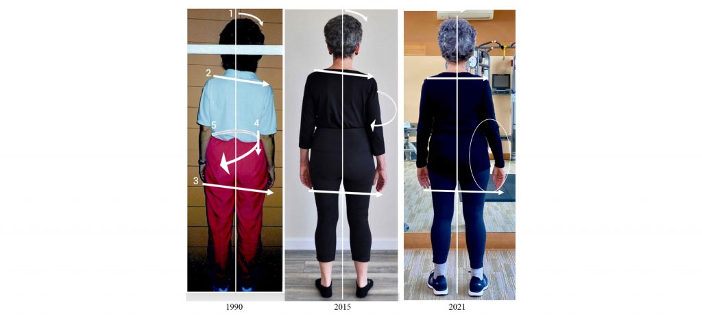 Walking Transformation - Dynamic Vitality